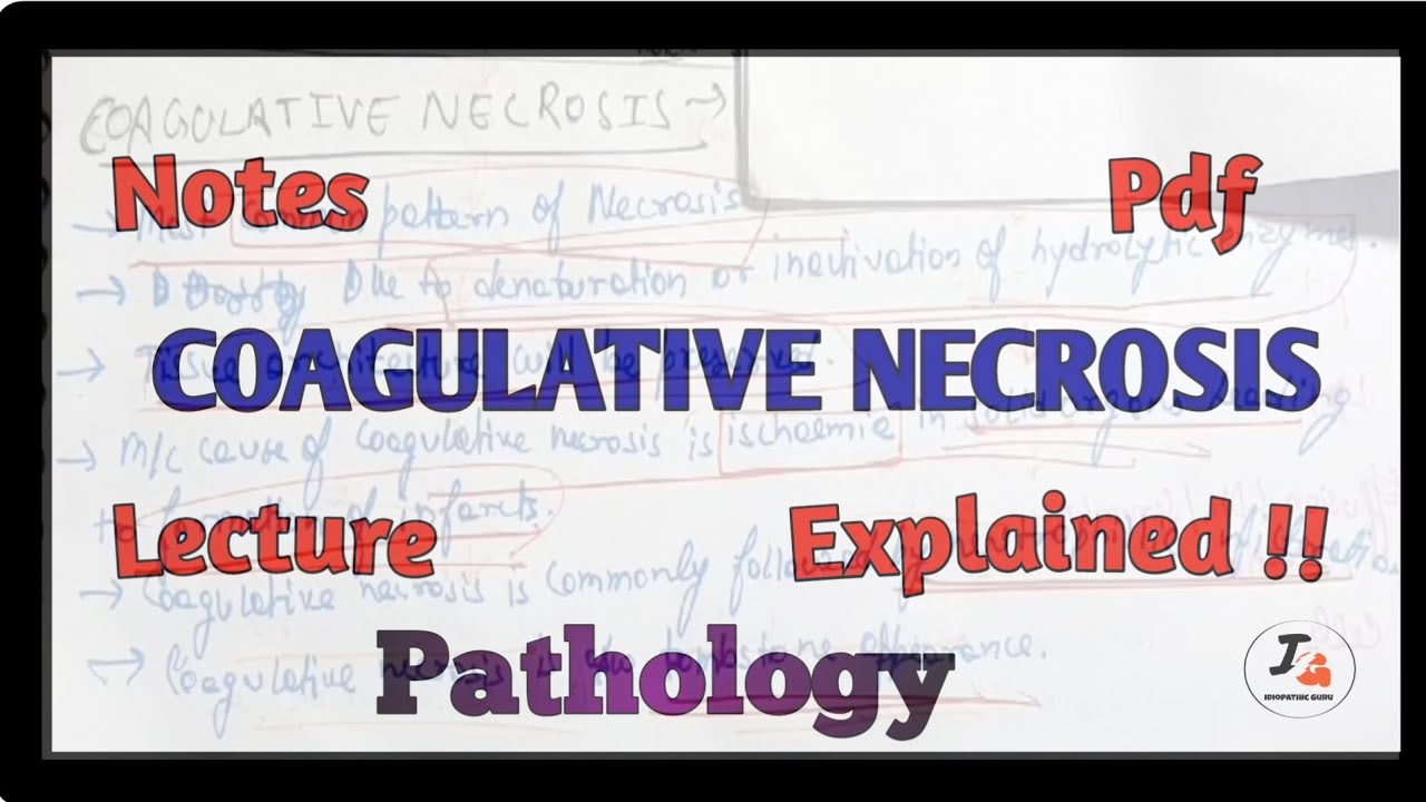 Coagulative Necrosis Pathology - YouTube
