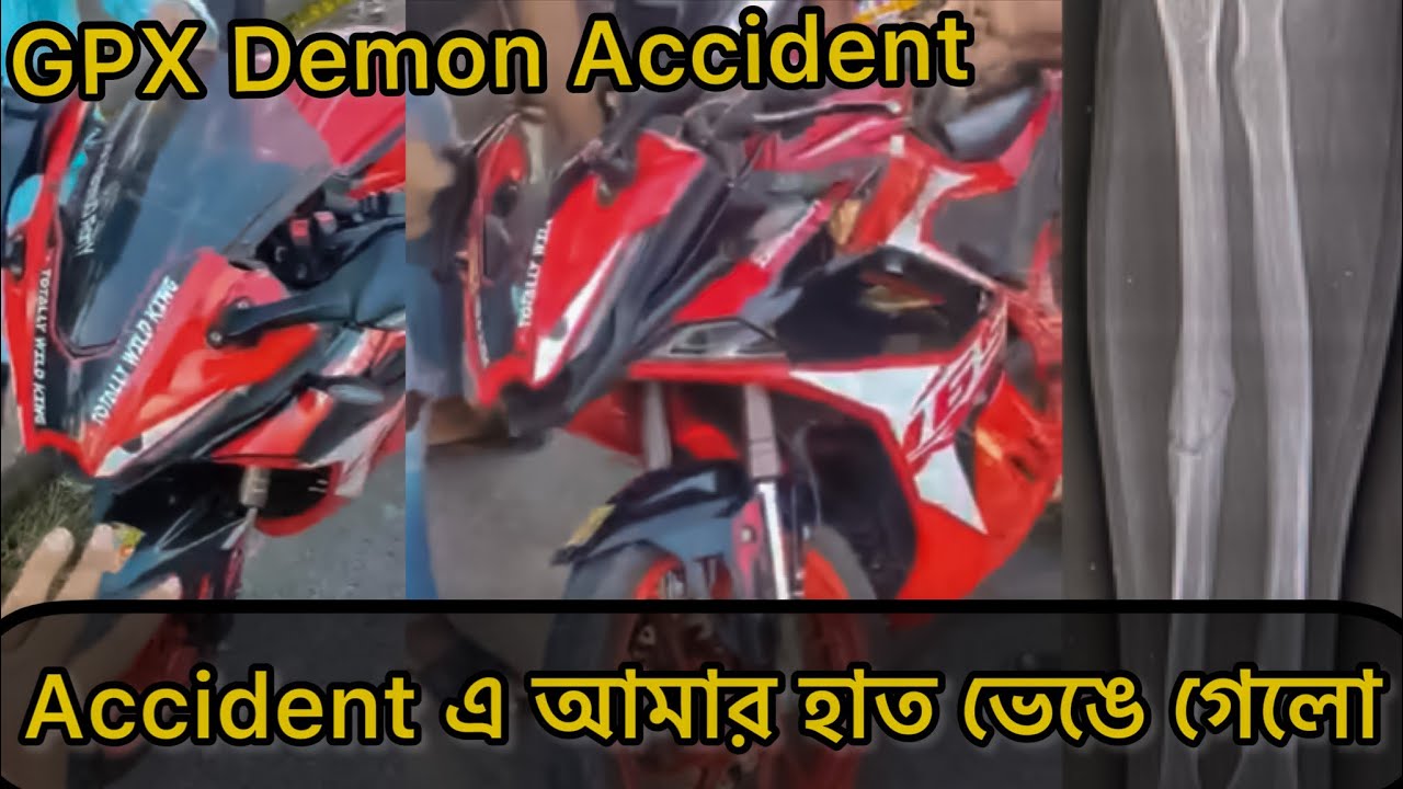 I Got into An Accident || Gpx Demon 165 Accident || Totally Wild KinG - YouTube