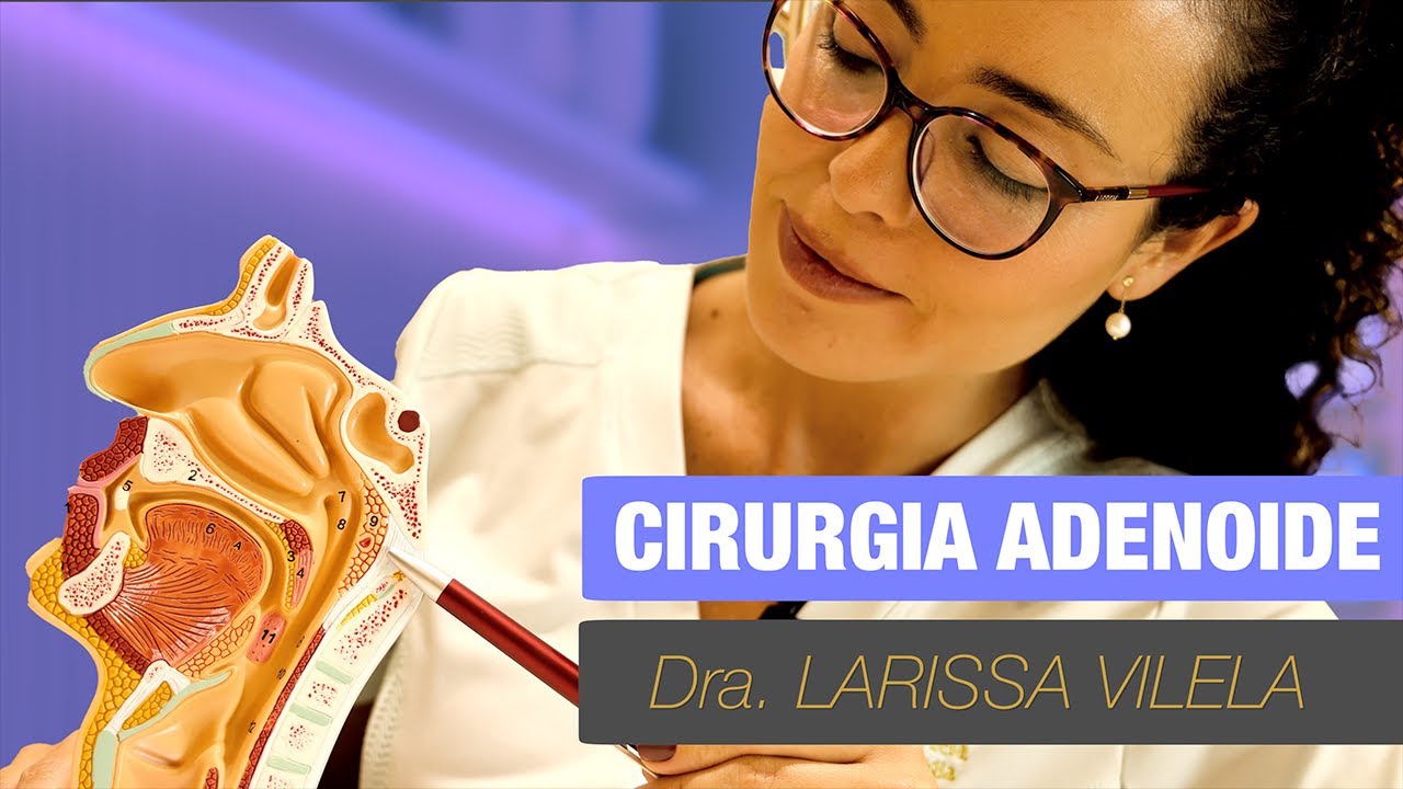 Cirurgia de adenoide: quando é indicada? Como é feita? Como é o pós ...