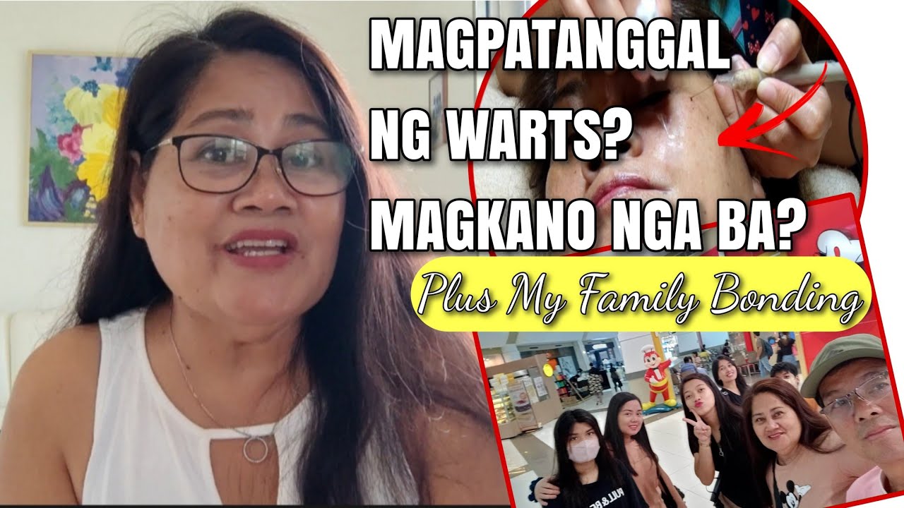 MAGPATANGGAL NG WARTS? MAGKANO BA?/And family bonding| Imelda Tampus ...