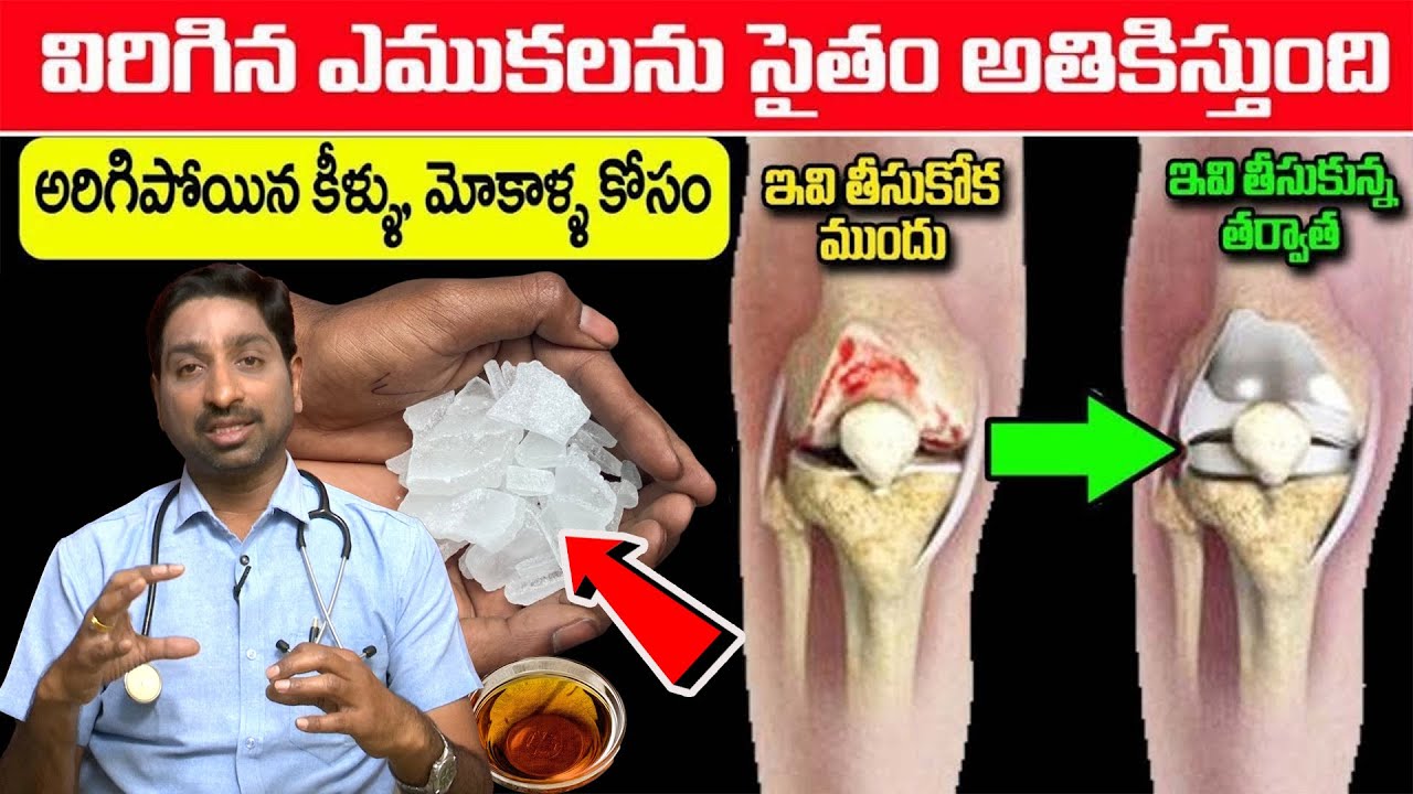 మోకాళ్ళనొప్పులు ఇంకతగ్గవు అనుకున్నవాళ్ళు కూడా లేచిపరిగెడతారు # ...