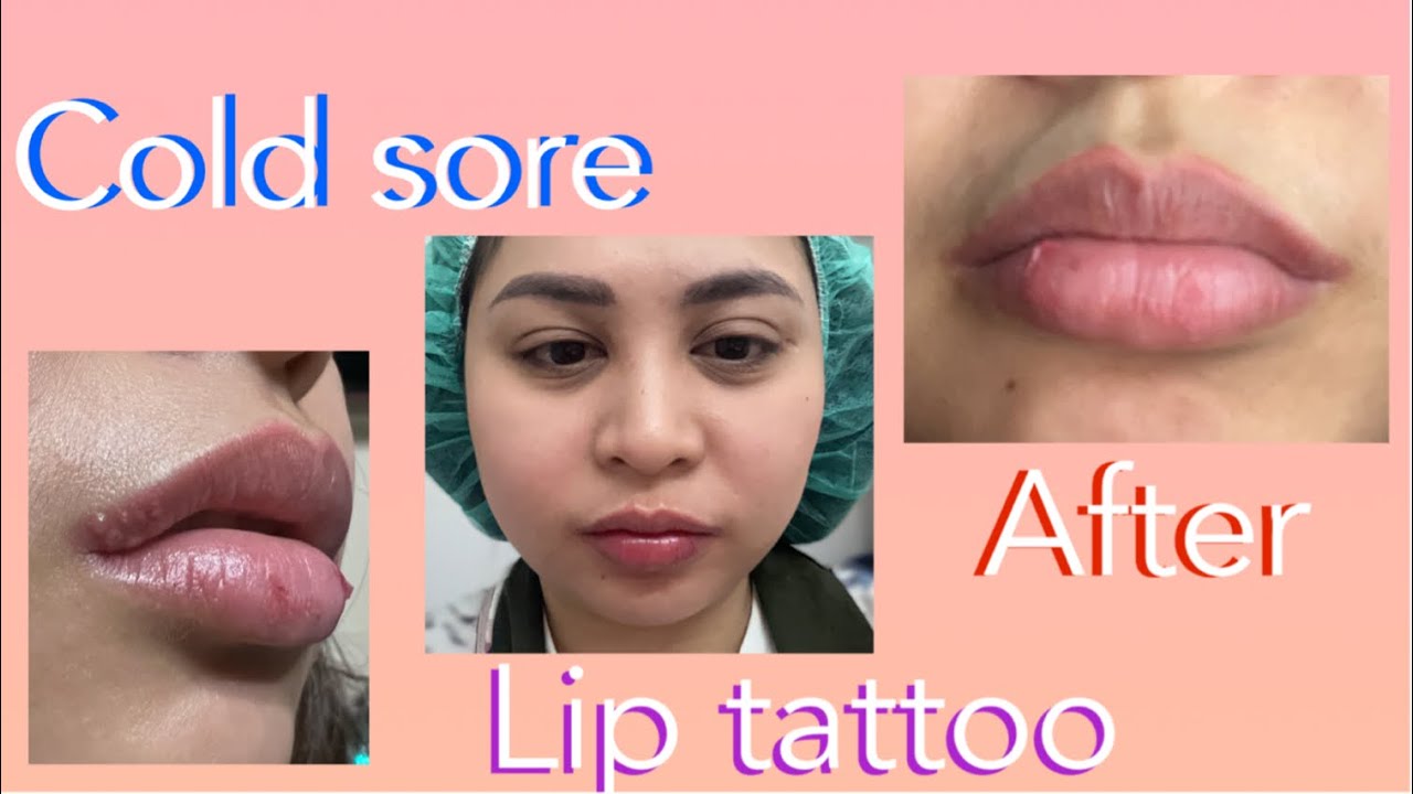 PERMANENT LIP TATTOO| LIP BLUSHING| COLD SORE| AFTER CARE #saudiarabia #dammam #riyadh - YouTube