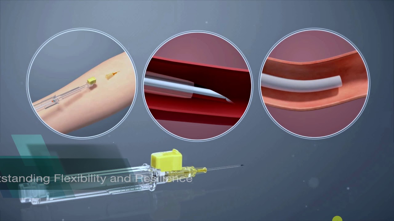Safety IV Catheter - YouTube