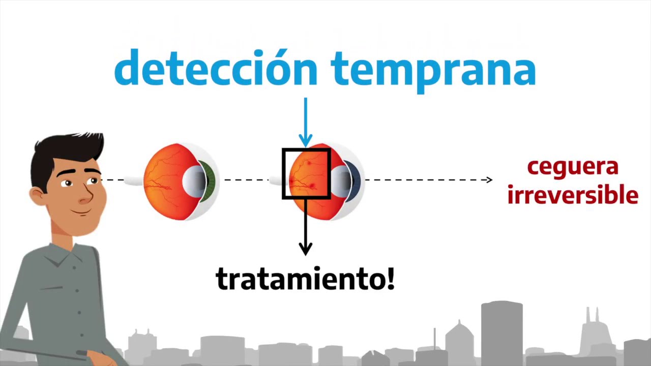 ¿Qué es retinar? - YouTube