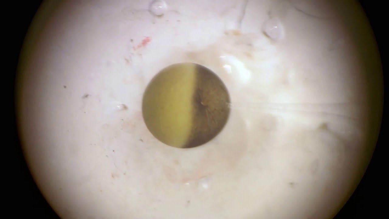 Frog oocyte microinjection - YouTube