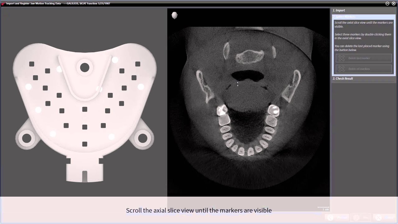 SICAT Function - Import & Register Jaw Motion Tracking Data - YouTube