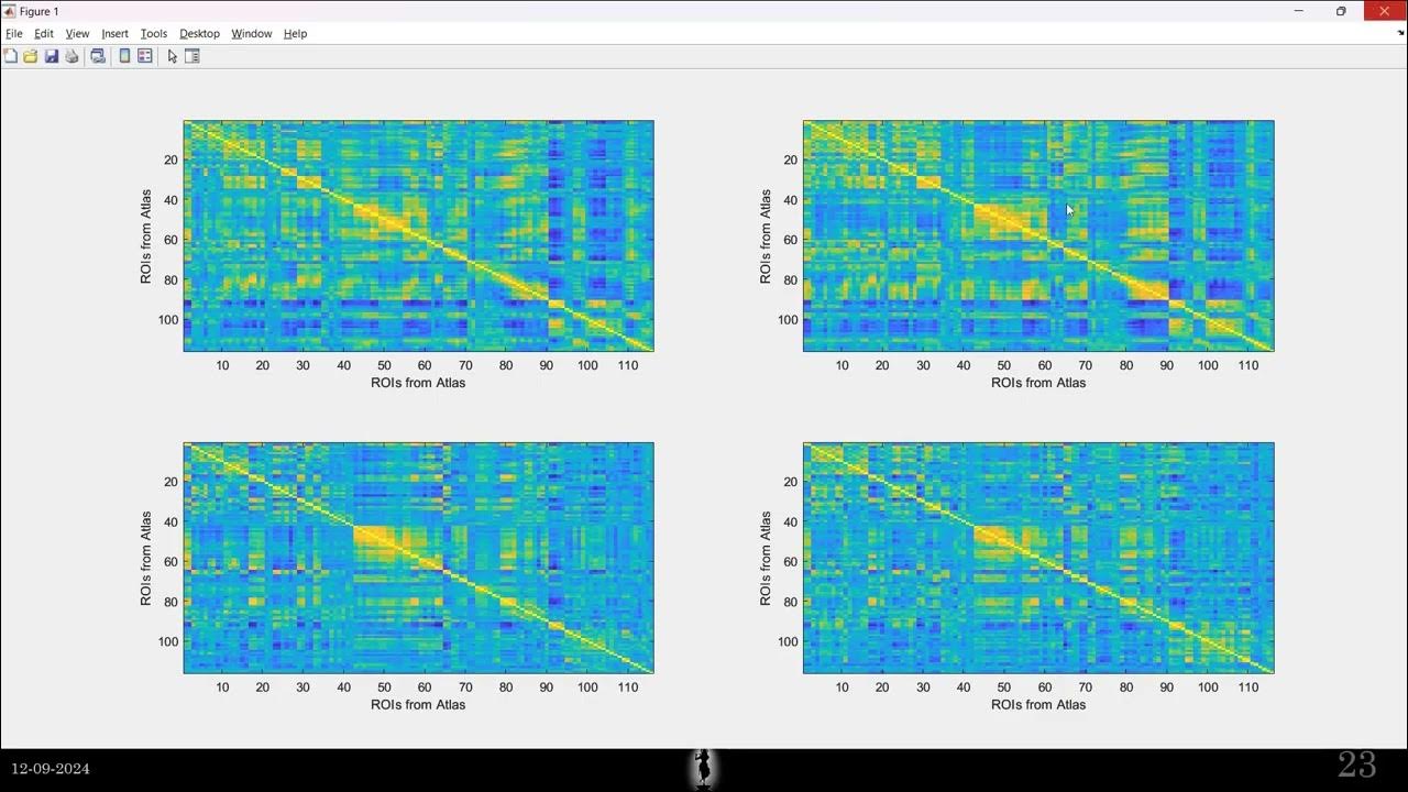 E7 | Brain fingerprinting using Functional Connectivity | Basics of MATLAB for MRI/fMRI - YouTube