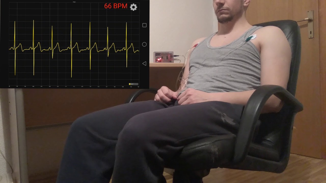 Electrocardiogram (ECG/EKG) Android Application Bluetooth ECG device ...