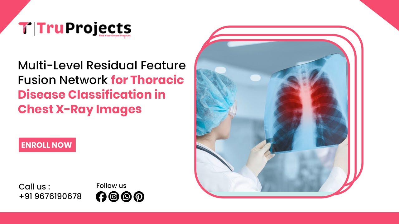 Multi Level Residual Feature Fusion Network for Thoracic Disease Classification in Chest X Ray ...