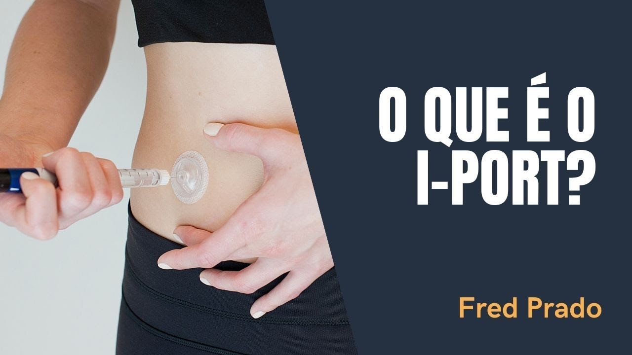 O que é e como aplicar o i-port, da Medtronic? Dispositivo para quem ...