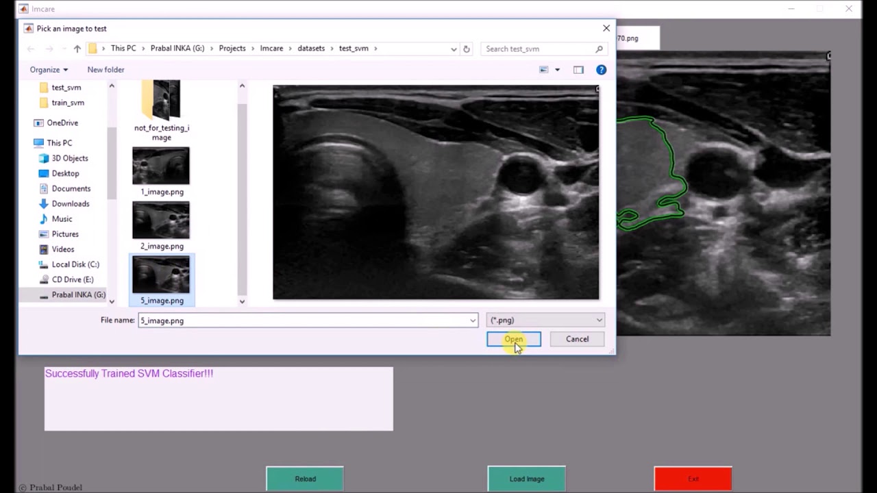 Imcare - Takes Care of Your Images - YouTube