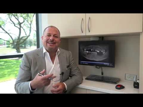 Dental Implant Consultations | Start Smiling Chicago - YouTube