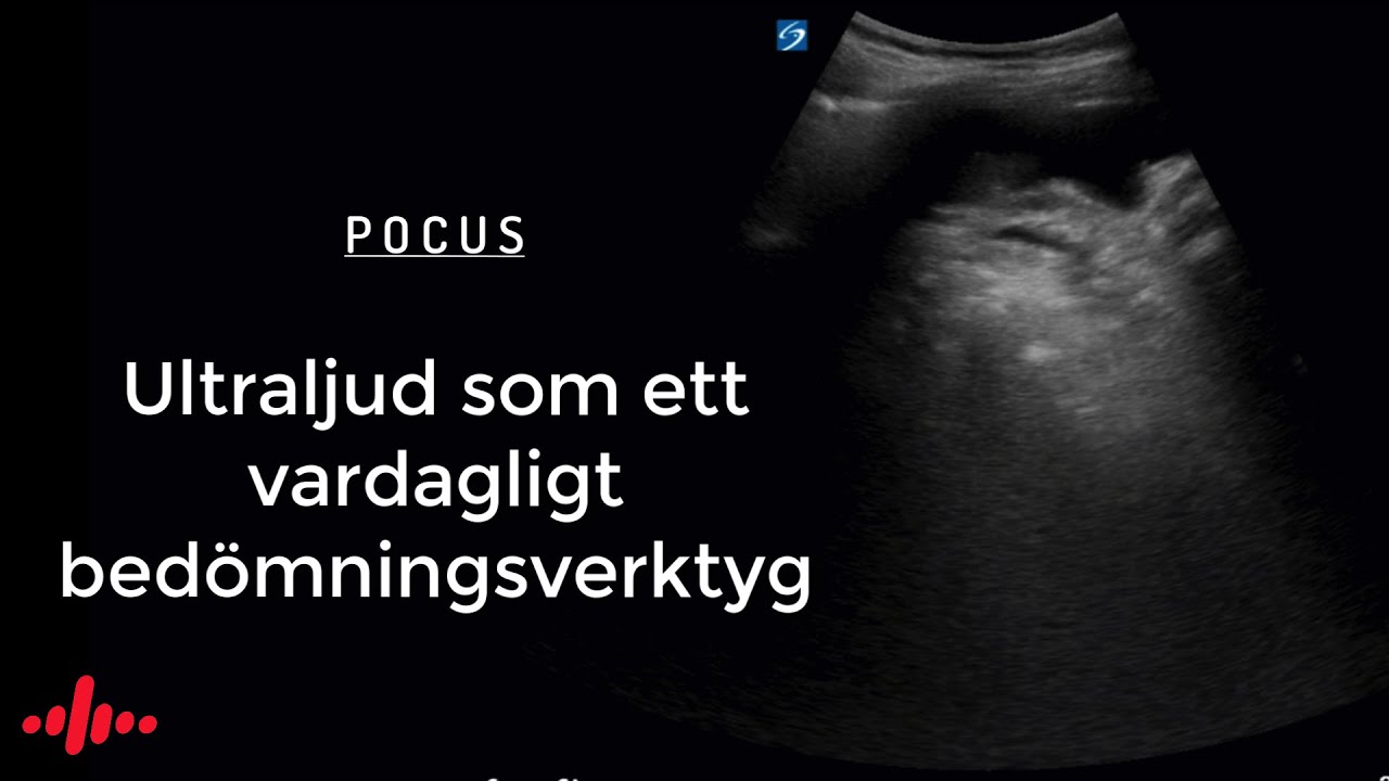 Ultraljud som ett vardagligt bedömningsverktyg - YouTube