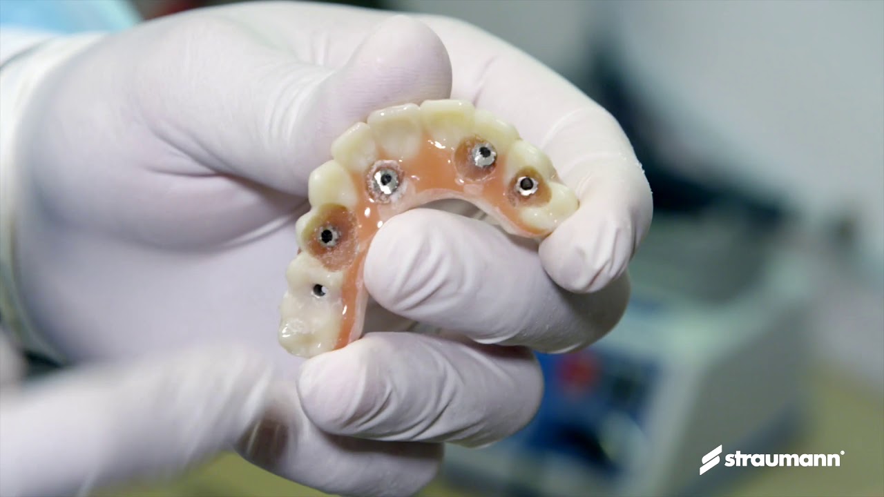 Smile in a Box Conversion - YouTube
