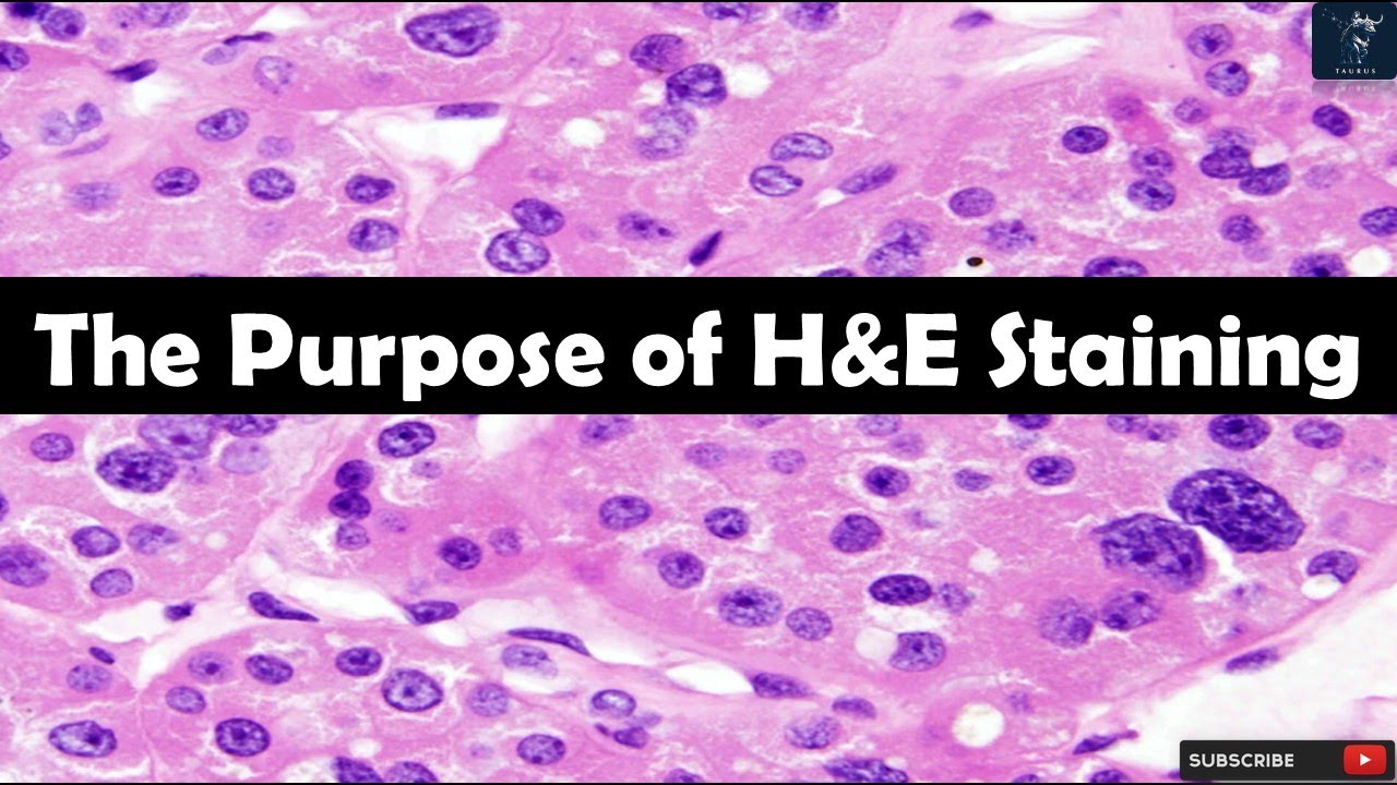 H&E Staining | Purpose of staining in histopathology | Human Touch in H&E Staining - YouTube