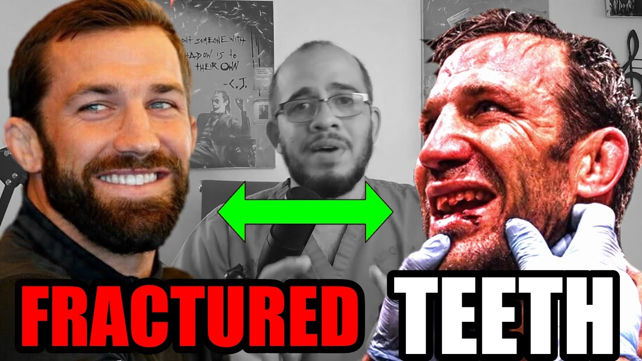 Luke Rockhold's tooth Fracture at BKFC 41 Explained by a Doctor - YouTube