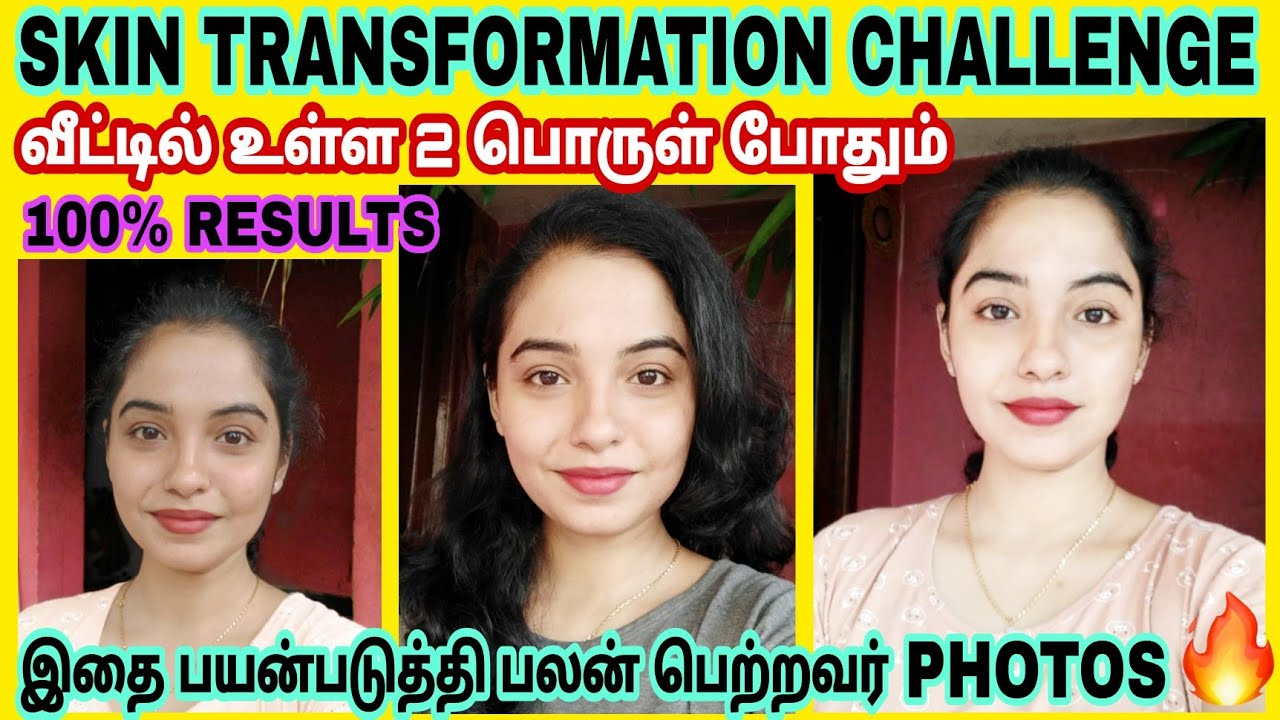 😱Top best skin transformation challenge 🔥 இதுவரை யாரும் செய்யாத சவால் 👍 ...