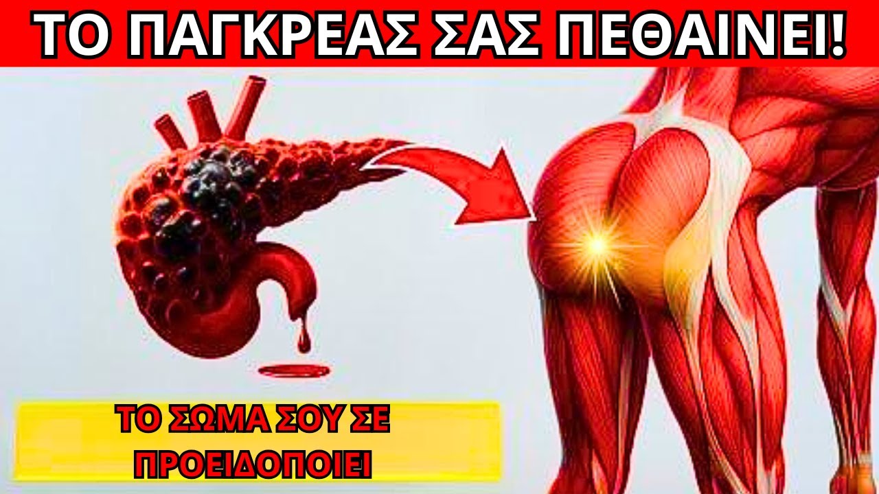 7 πρώτα σημάδια καρκίνου στο πάγκρεας – Μην τα αγνοήσεις! - YouTube