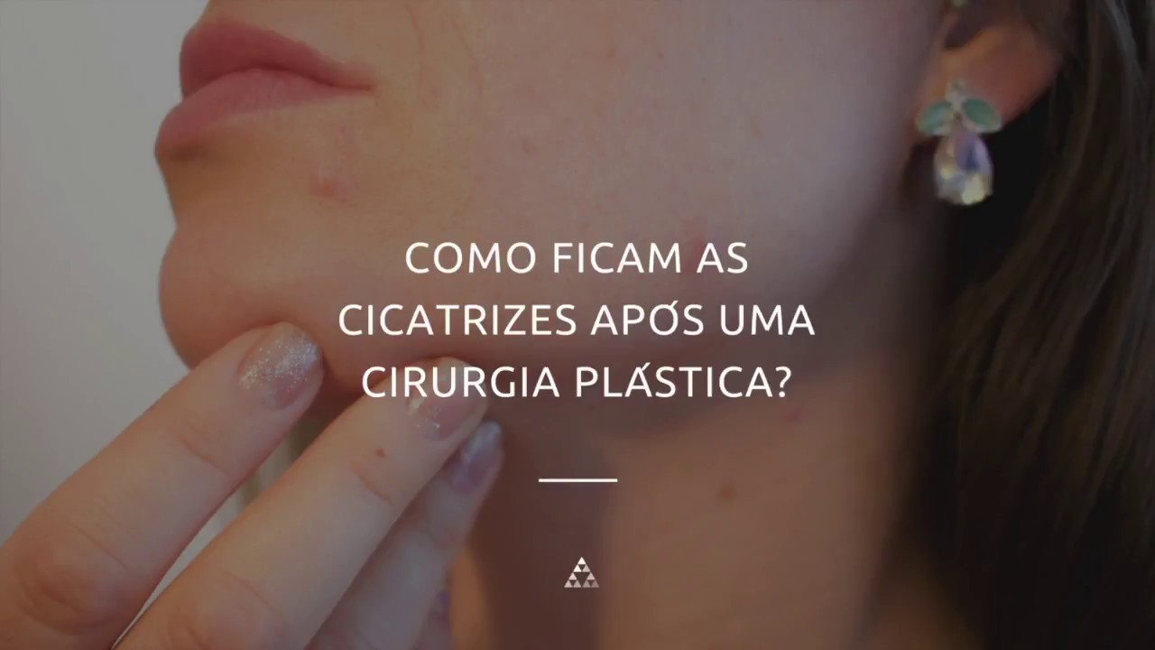 COMO FICAM AS CICATRIZES APÓS UMA CIRURGIA PLÁSTICA? - YouTube