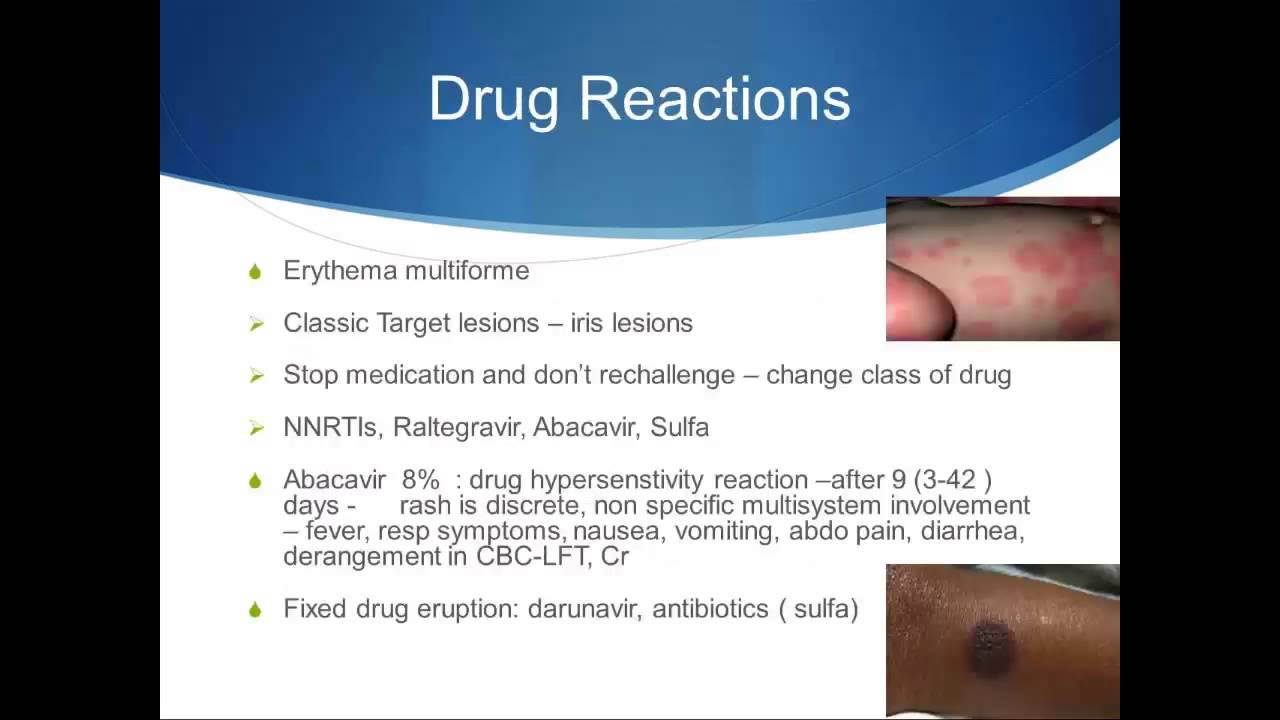 Dermatology in HIV - Nancy Rihana, MD - YouTube