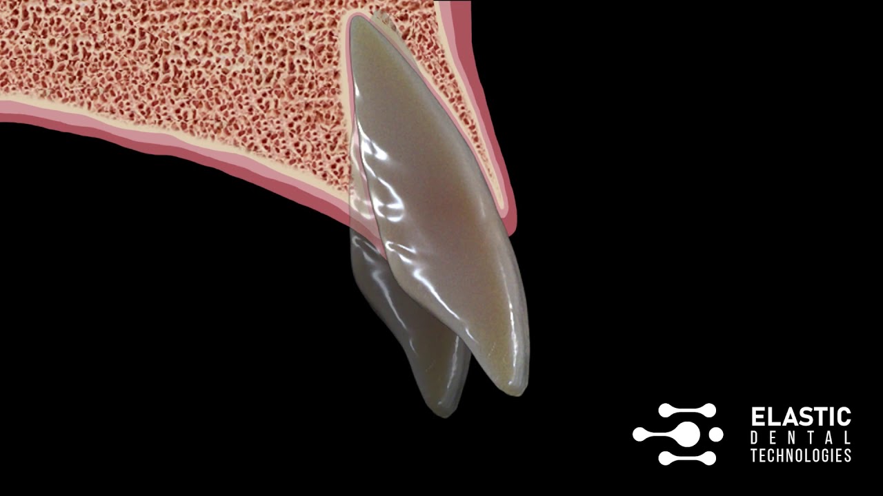 Relative intrusion and extrusion - YouTube
