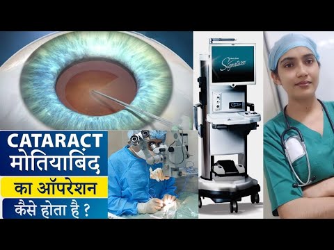 Phacoemulsification cataract surgery Instrument's & Stapes in Hindi ...