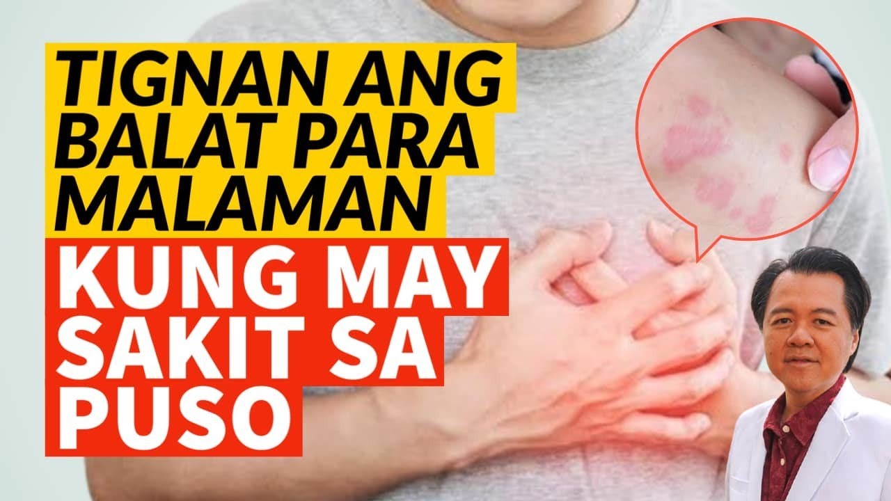Tingnan ang Balat Para Malaman Kung May Sakit sa Puso. (Repost Video ...