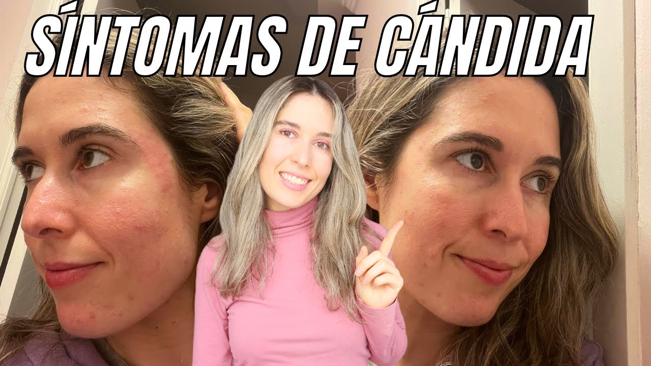 SÍNTOMAS QUE ME PROVOCA EL HONGO CÁNDIDA Y PARÁSITOS + Nuevo protocolo ...