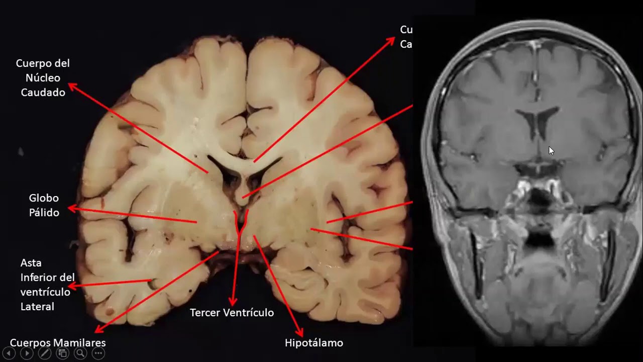 Anatomía SNC - YouTube