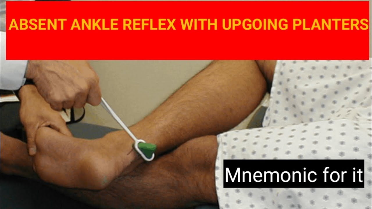 Absent ankle Jerks with Upgoing Planters. Mnemonic for it - YouTube