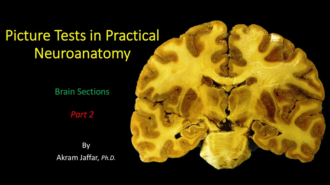 Picture Test in Neuroanatomy Brain Sections 2 - YouTube