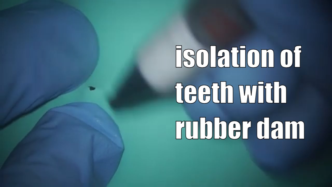 isolation of teeth with rubber dam - YouTube