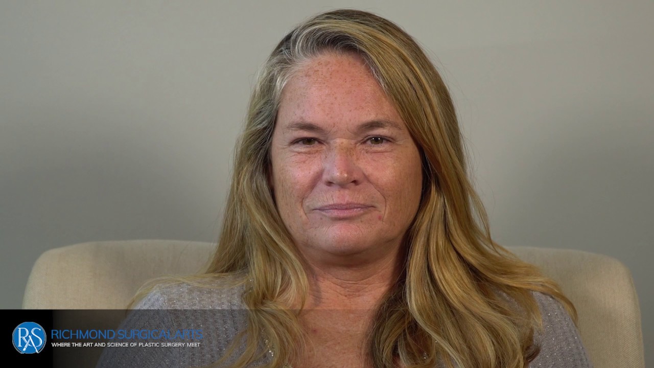 FACELIFT - Real Patient Story - Richmond Plastic Surgeon Dr. Lynam ...