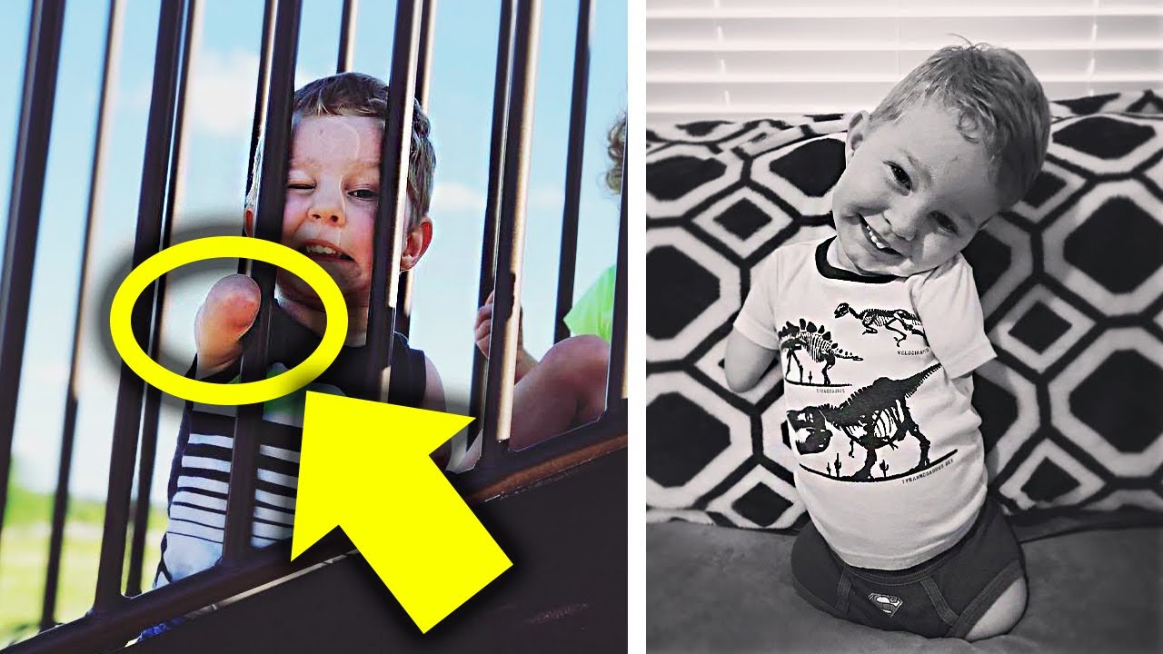 4 Years After This Boy Was Born Without Limbs, He Achieved A Feat That ...