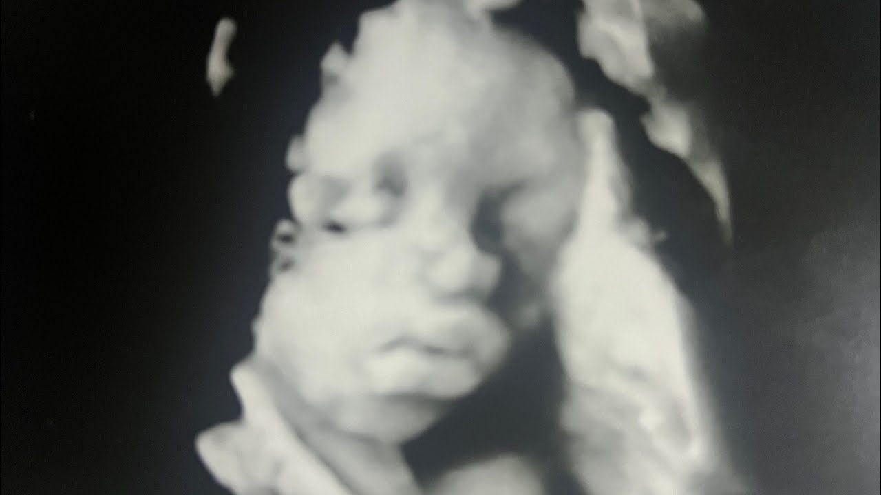 OUR SECOND GRANDSON IS HERE. #memories #2024 - YouTube