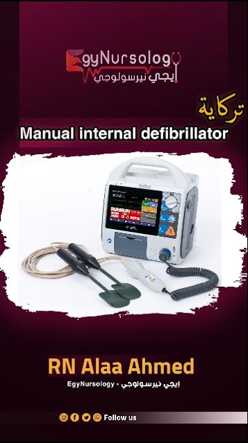 تعرف ايه عن الـ Manual internal defibrillator؟ - YouTube