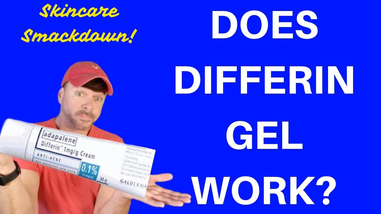 Differin Gel Review | DOES IT REALLY WORK? | Chris Gibson - YouTube