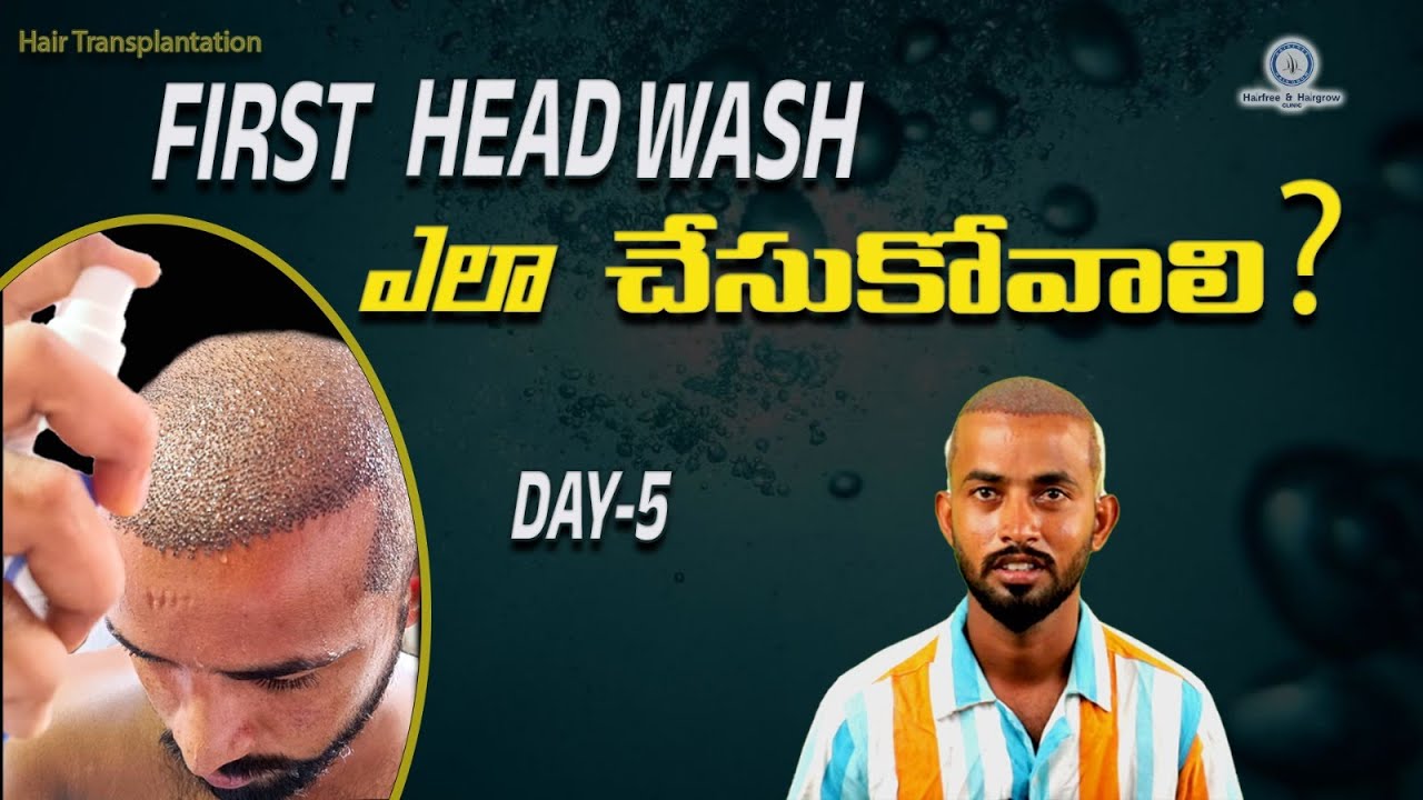 how to do first head wash | first head wash | ofter transplant process ...