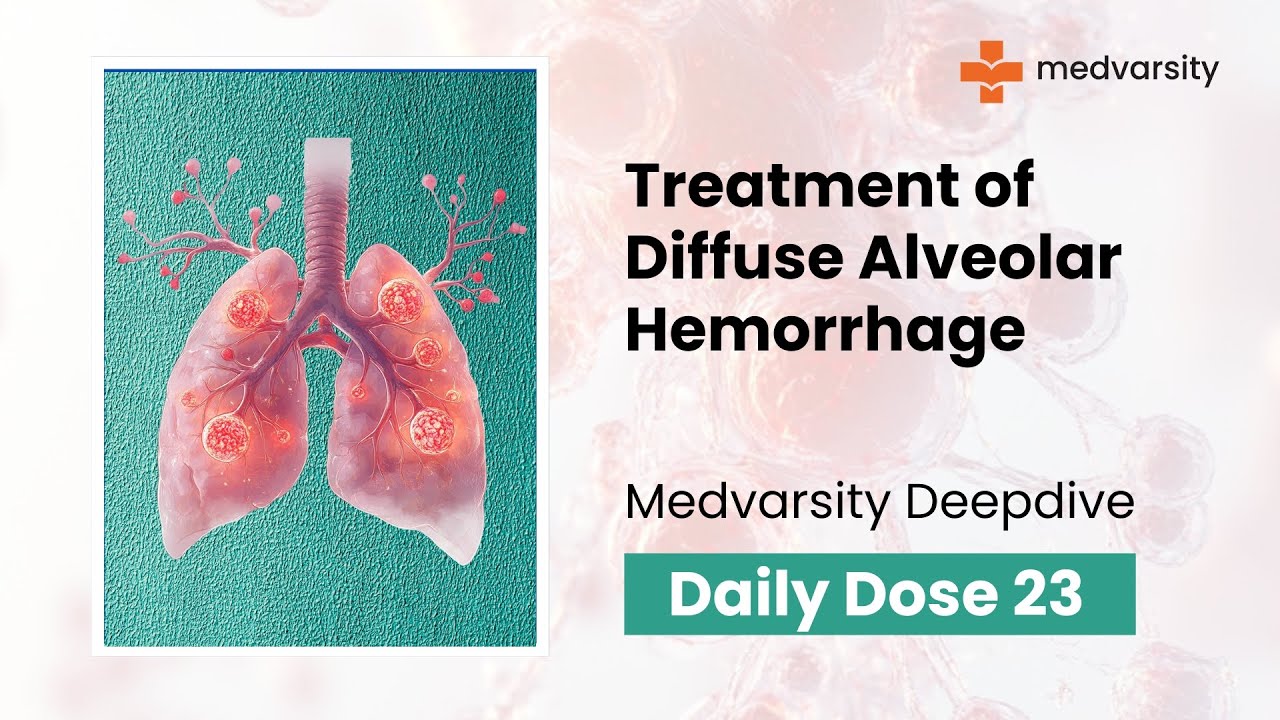 Diffuse Alveolar Hemorrhage Treatment Secrets Revealed! - YouTube