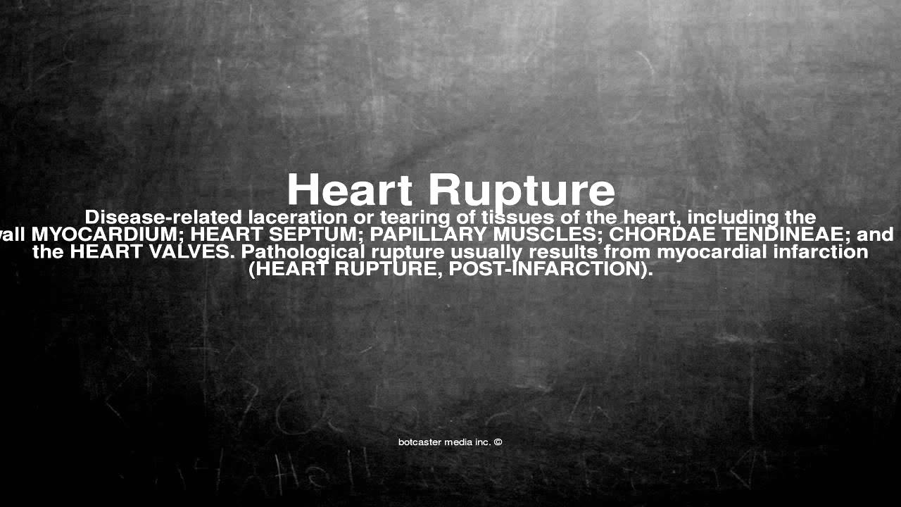 Medical vocabulary: What does Heart Rupture mean - YouTube