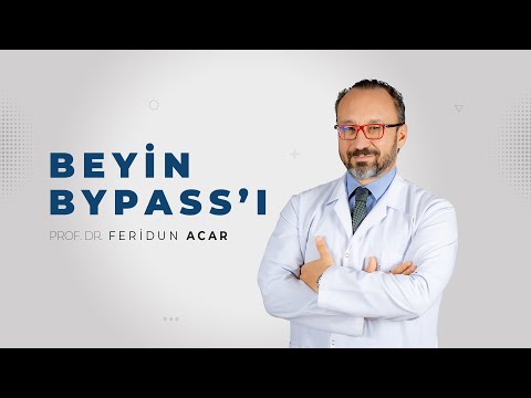 Beyin Bypass'ı | Prof. Dr. Feridun Acar