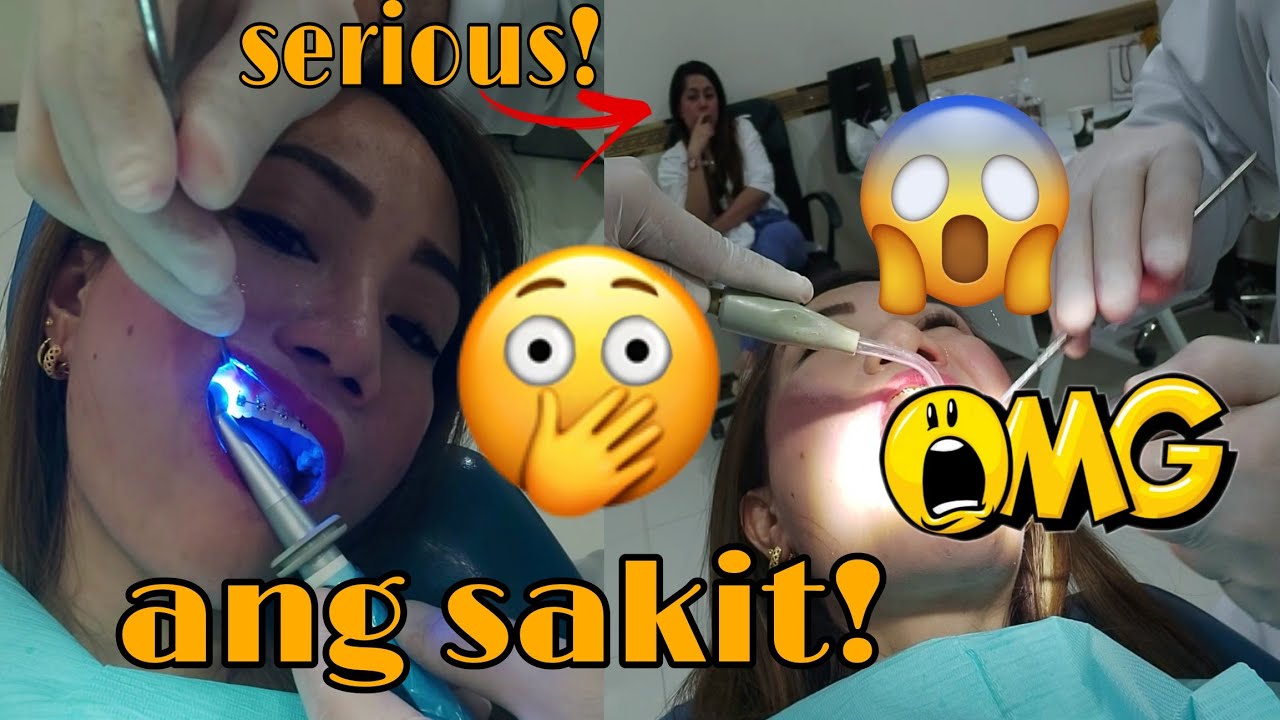 TOOTH FILLING | DAWUR DAWUR OFW LIFE| BICOLANANG SUTIL - YouTube