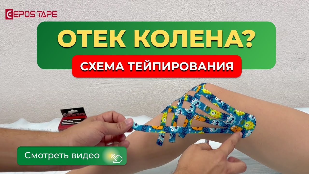 Отеки коленного сустава Тейпирование колена Тейпы от отеков Youtube