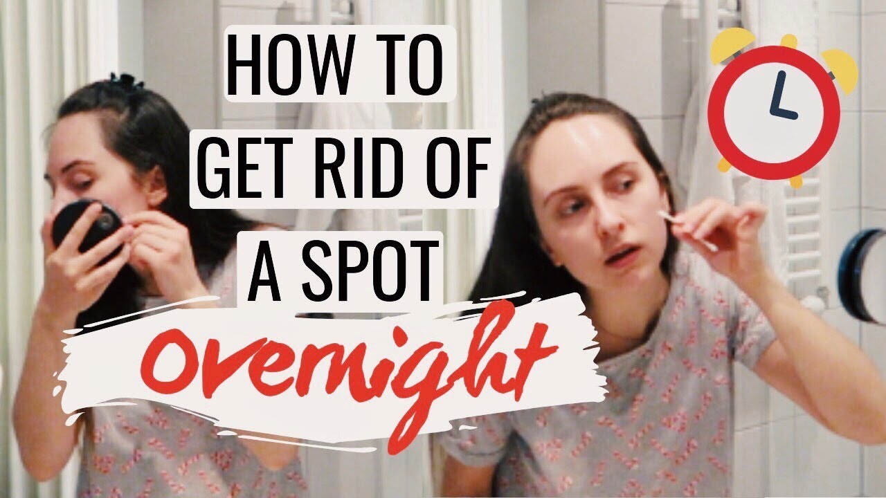 HOW TO GET RID OF A SPOT OVERNIGHT YouTube how-to-get-rid-of-a-spot-overnight-youtube