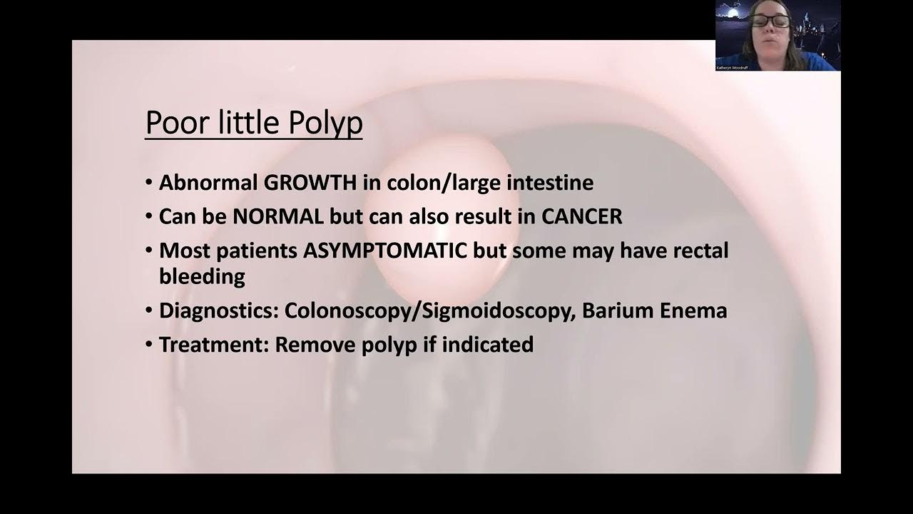Adult Med/Surg: Polyp NEW Lecture - YouTube