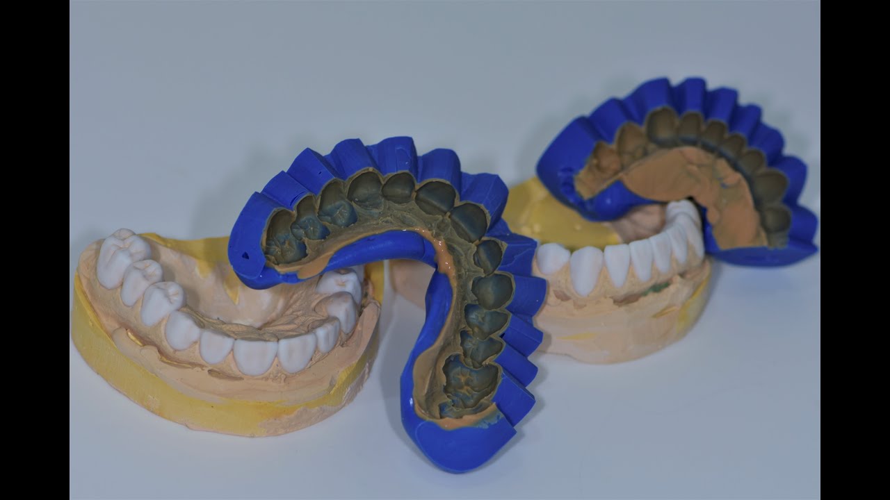 Silicone Index Fabrication - YouTube