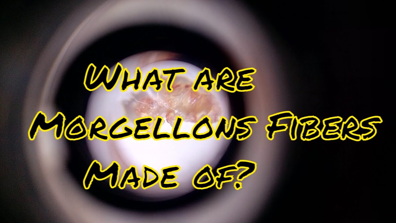 What are Morgellons fibers made of? Morgellons disease filaments ...