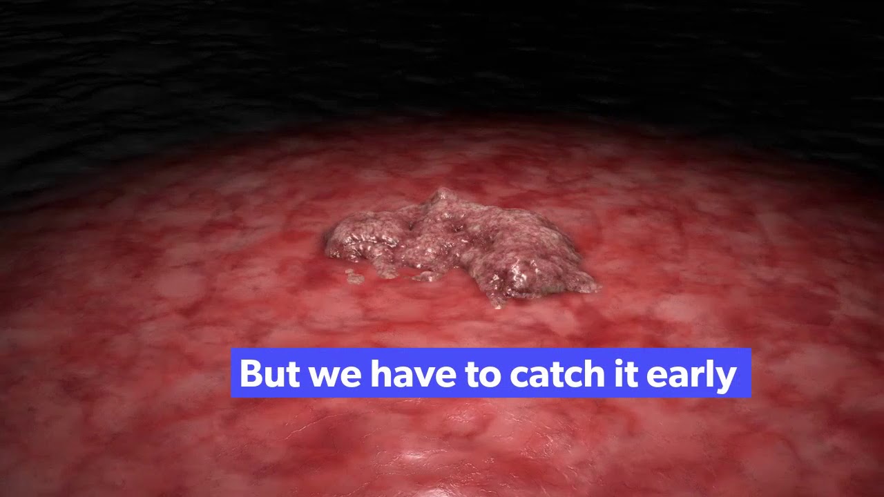 Skin Cancer Treatment in Oasis Dermatology Group, PLLC; Dermatology ...