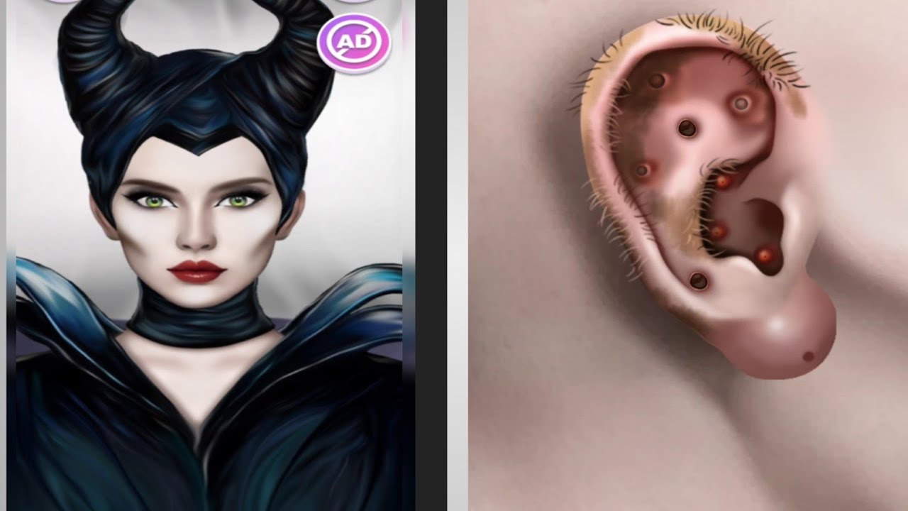 ASMR Satisfying Ear Cleaning | Asmr Blackhead Removing Animation| Ear ...