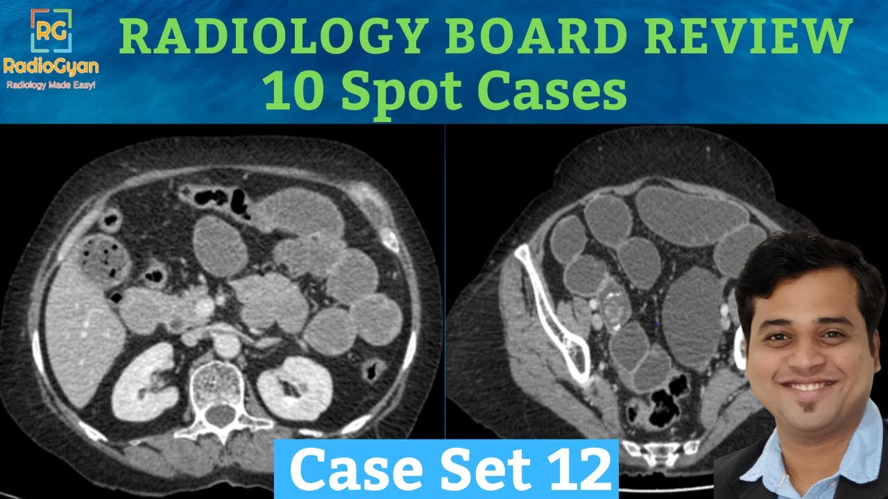 Case-based Radiology Board Review [Quiz and Discussion] | Set 12 | Oct ...